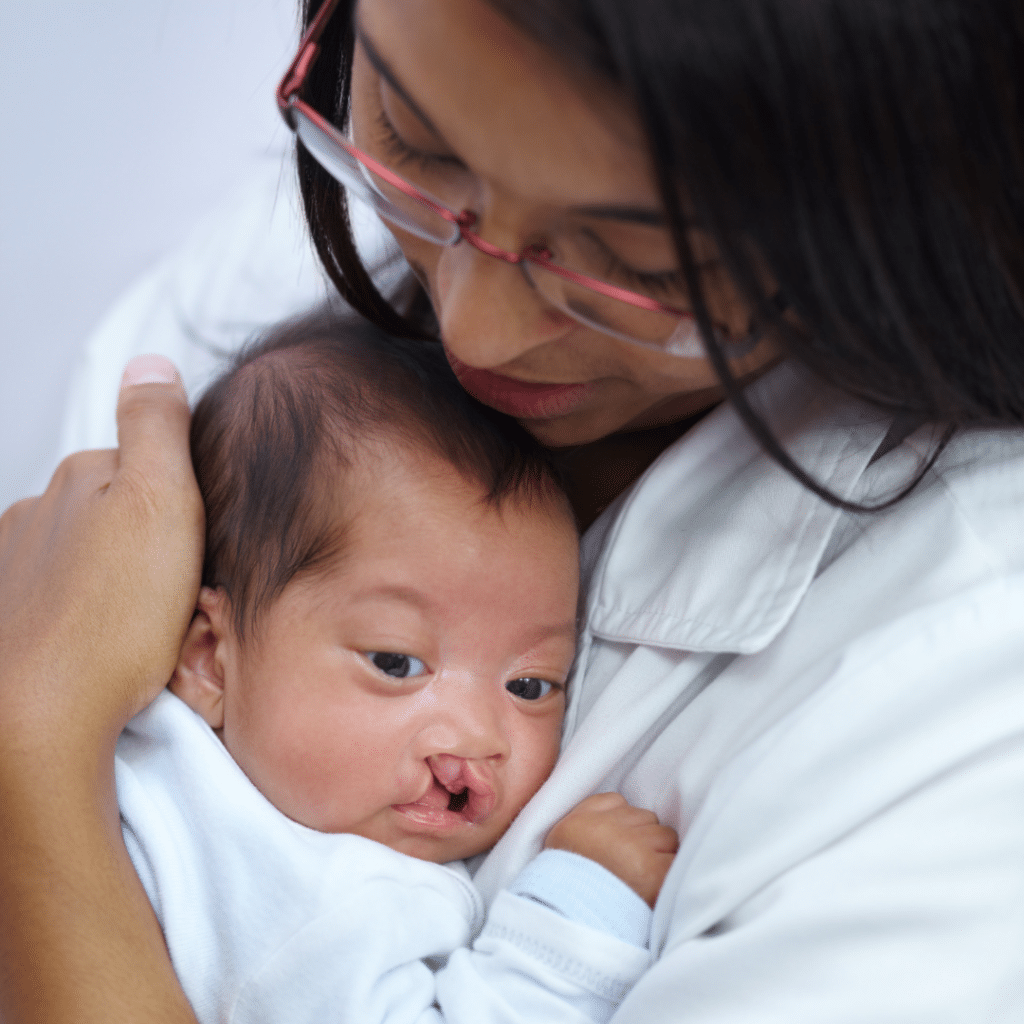 Cleft Lip and Palate Resources ⋆ Childrens Clinics in Southern Arizona
